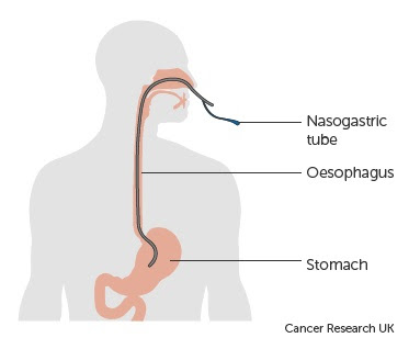Ukuran Selang Ngt - Y Soalan
