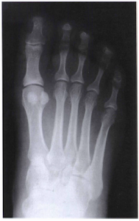 AP PROJECTION: FOOT - RadTechOnDuty