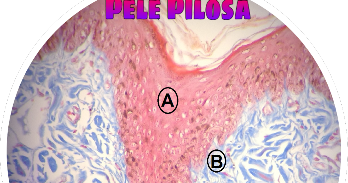 Pele Pilosa (Camadas)