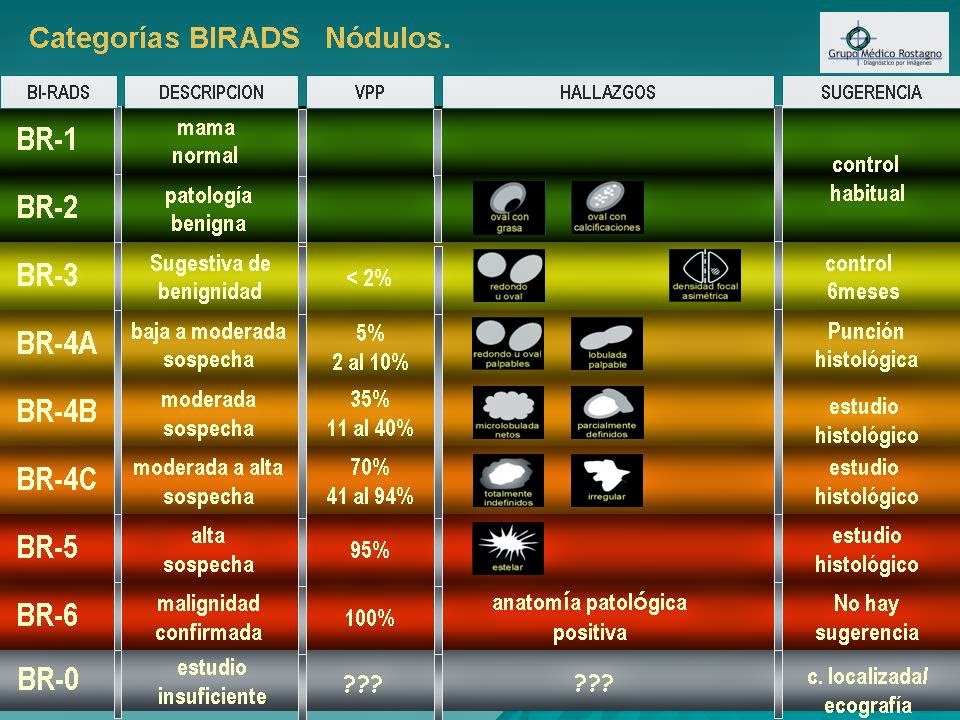 Classificação Acr Bi-rads 2 - BRAINCP