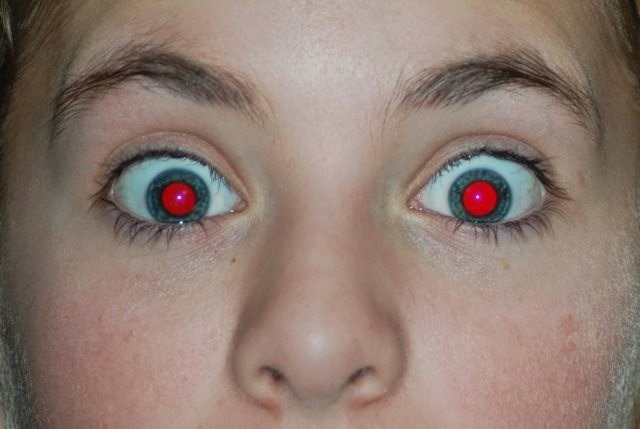 Óptica HM: Por que saímos com os olhos vermelhos em fotografias tiradas ...