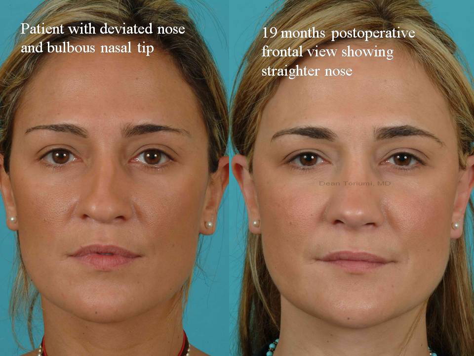 Dr. Dean Toriumi Reviews: Dean Toriumi Reviews: Patient that presents ...