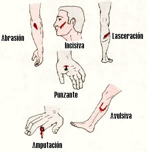 24 TES: Contusiones, Heridas y Hemorragias