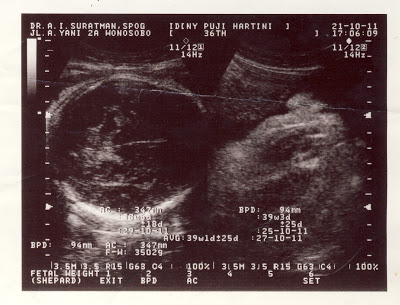 Penting!! Cara Baca Foto USG - VEJWAN