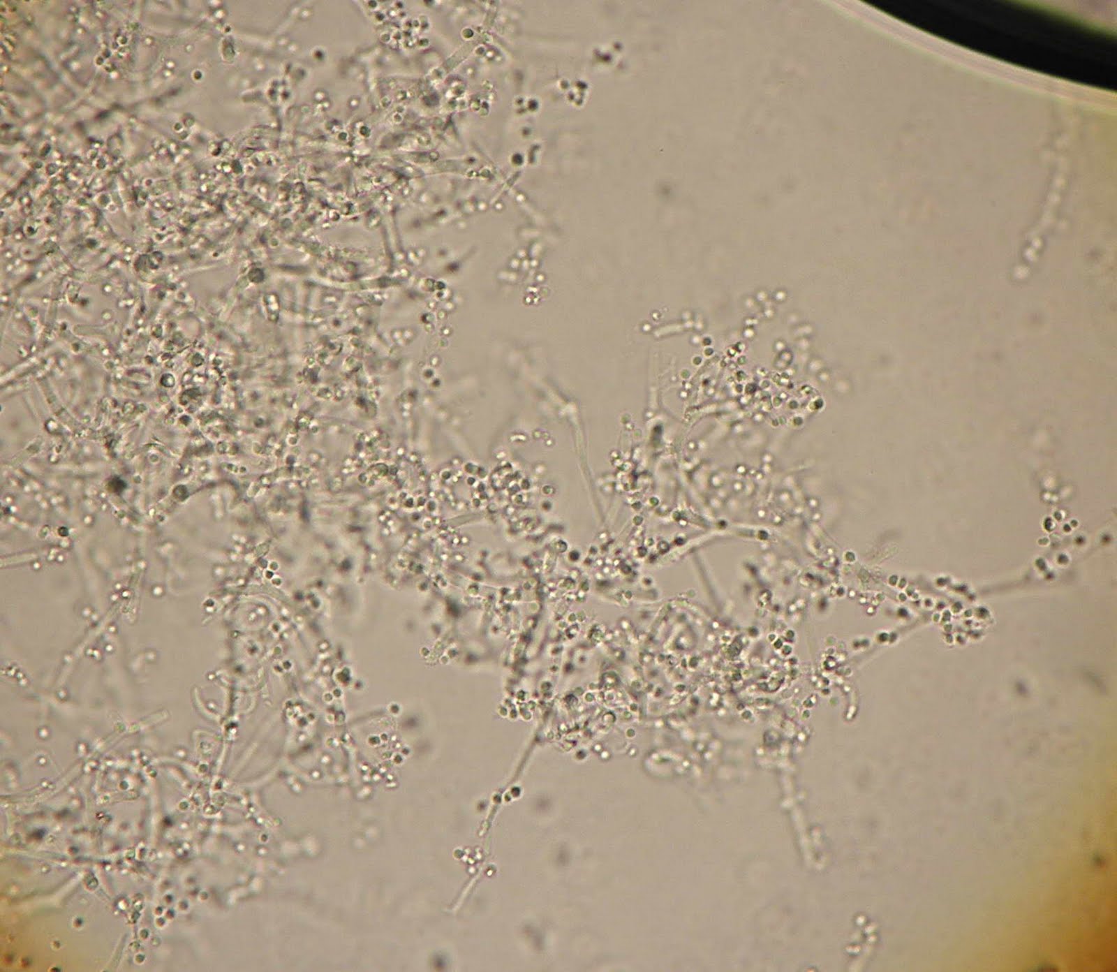 ATLAS MICOLOGIA: TRICHOPHYTON MENTAGROPHYTES