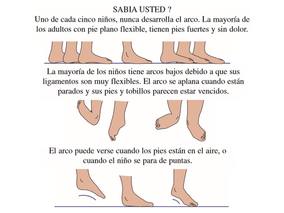 Mamás gallina: Lo que los padres deben saber sobre el pie plano, pies ...