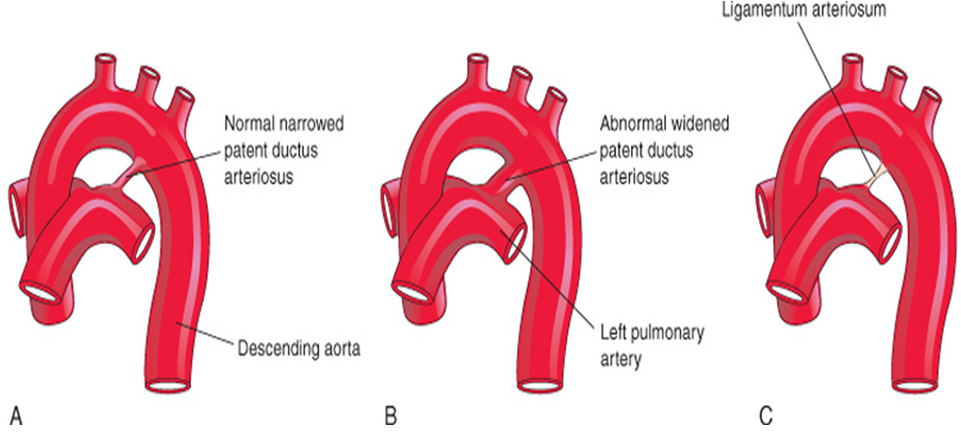 MBBS Medicine (Humanity First): Cardiovascular Embryology