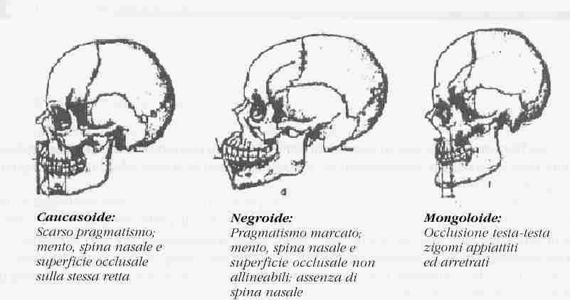 Seguindo os passos da História: O racismo científico: da teoria a prática
