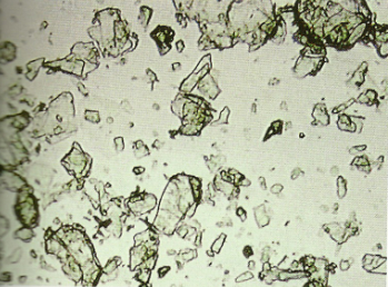 Urine Artifacts ~ Medical Labs Everyday