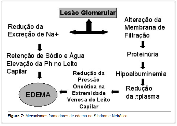 Mecanismos de Formação de Edemas ~ Fisionerds