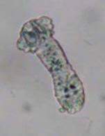 Aquarium, Fish Parasites, Worms; Planaria, Nematodes, Detritus, Anchor