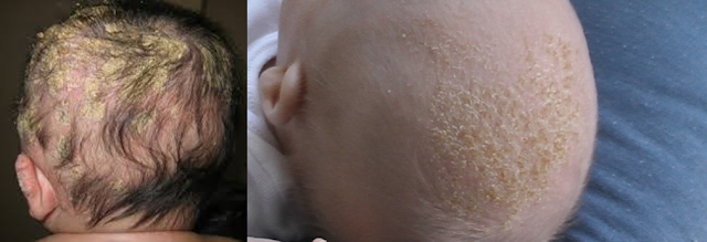 Bibi Tips : LA COSTRA LÁCTEA