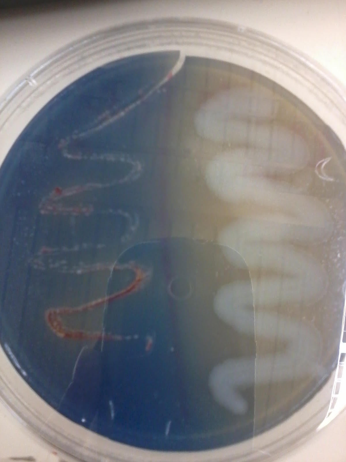 Lipid Hydrolysis Test