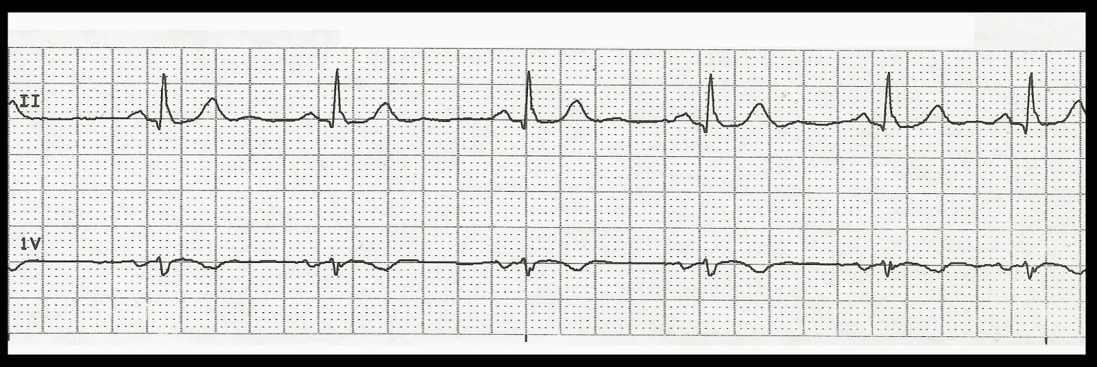 Practice EKG Rhythm Strips 211