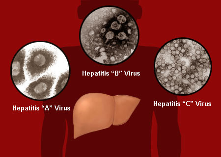 Apa Itu Hepatitis? Mari Eliminasi Hipatitis di Dunia