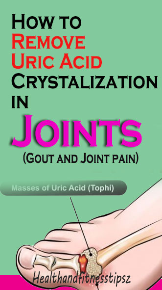 How to Remove Uric Acid Crystalization in Joints (Gout and Joint pain ...