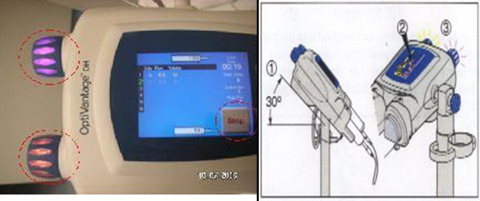 Cafe Radiologi: PENATALAKSANAAN CT-SCAN PADA KASUS Ca PROSTAT