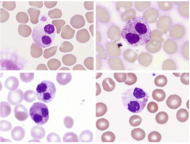 VETERINARY HEMATOLOGY DEXTERVET: Pelger-Huet neutrophils