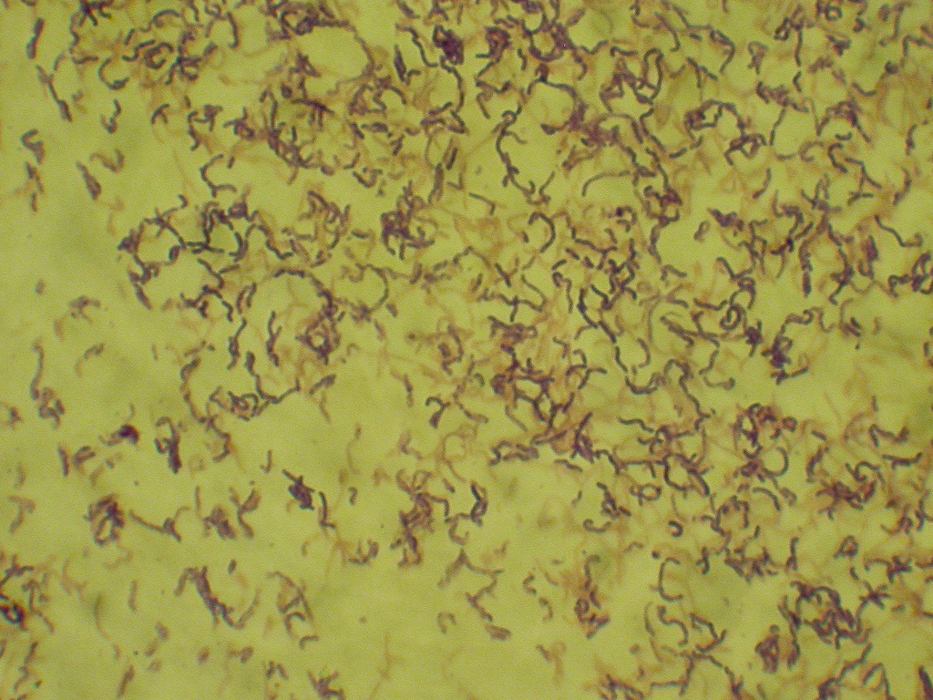 Caso 68: Infecciones por Erysipelothrix rhusiopathiae – Guía ...