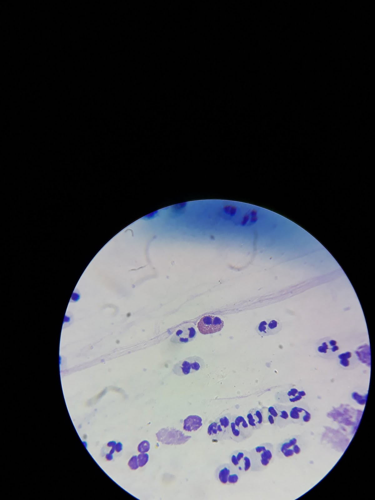 Citograma : Mastocitos en Acción, el Moco Nasal