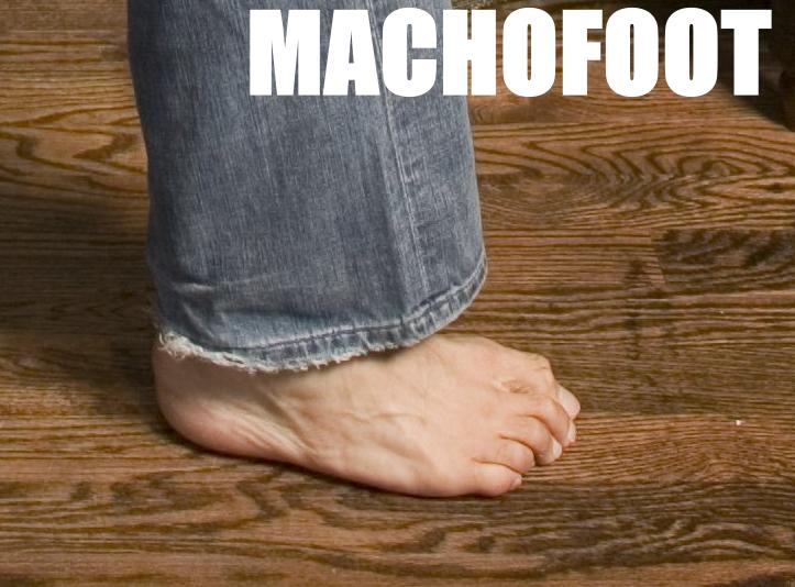 MACHOFOOT: CAMERON MATHISON