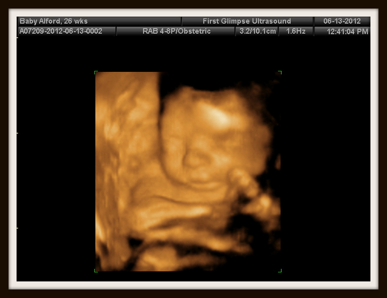 Us + Two: 25 Weeks 6 Days- 3D Ultrasound