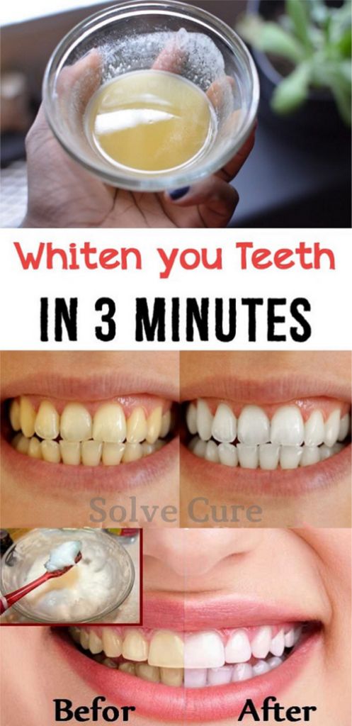 Whiten Your Teeth In 3 Minutes Healthymasters whiten-your-teeth-in-3-minutes-healthymasters