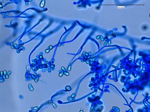 Fun With Microbiology (What's Buggin' You?): Trichothecium roseum