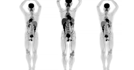 Ob/Gyn Updated : Human images from the first full-body scanner unveiled