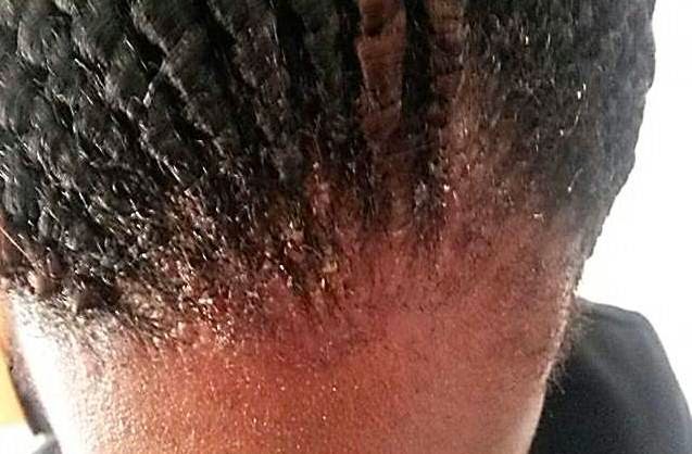 Deepbrown & Kinks: YOUR HAIRLINE, YOUR RESPONSIBILITY