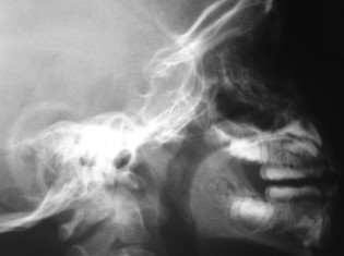 NOSOLOTECNICOS: CAVUM