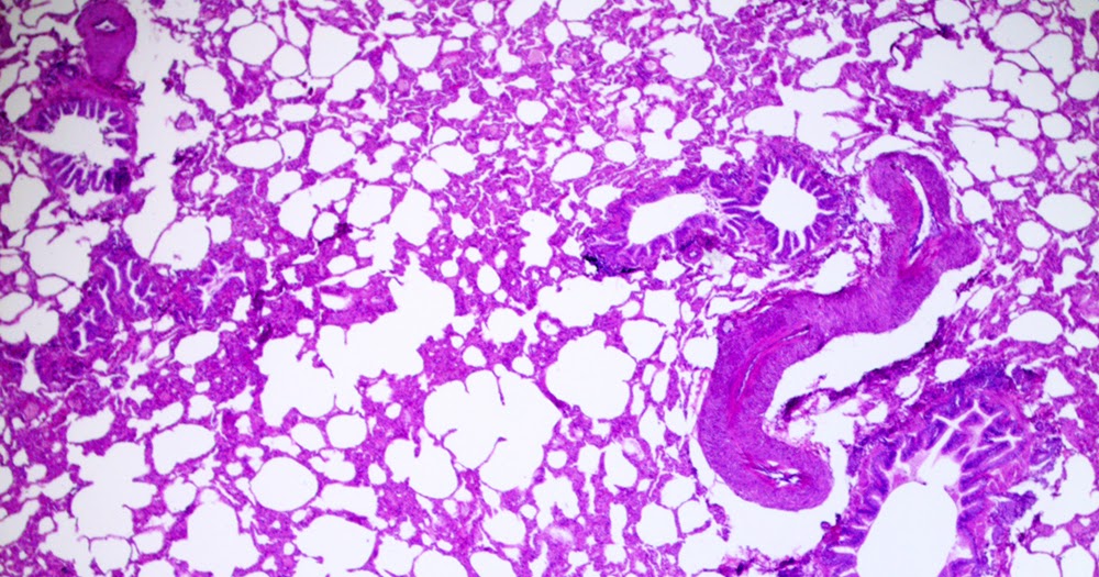 Microscope World Blog: Lungs under the Microscope