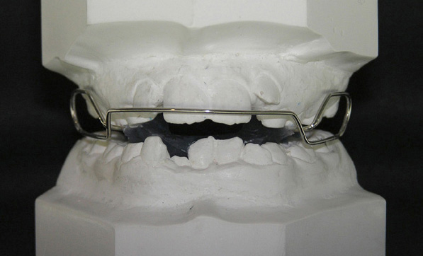 APARATOLOGIA ORTOPEDICA: BIONATOR ESTANDAR