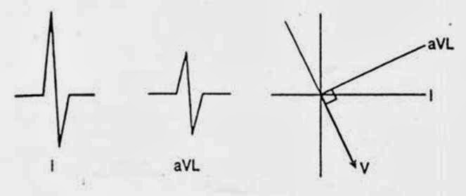 dokter-medis: Menentukan Sumbu Jantung Secara Cepat