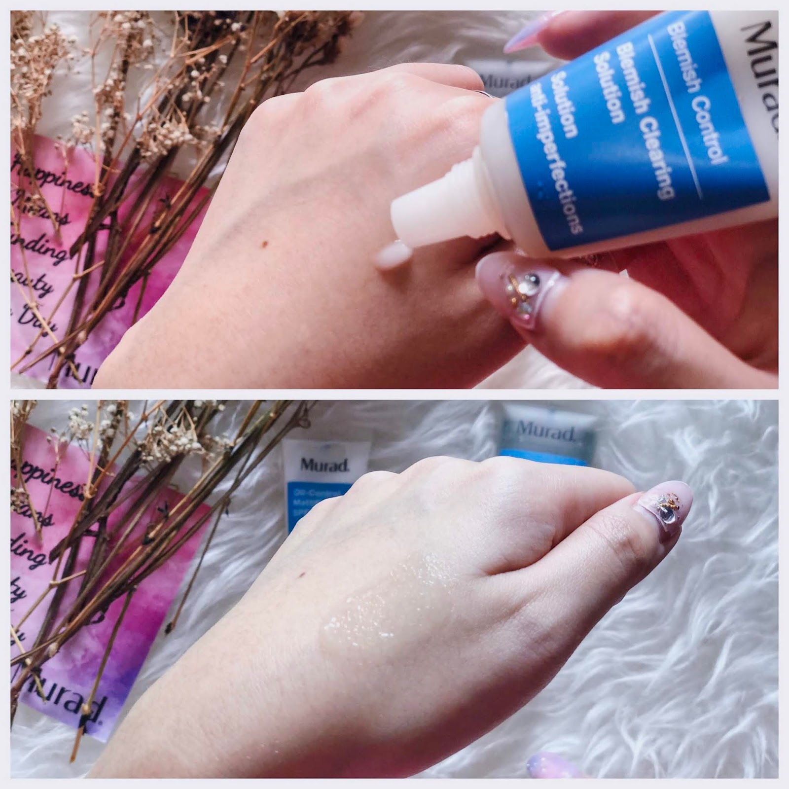 Dr. Murad Blemish control 30 days starter kit - Sherlyn Lifestyle ...