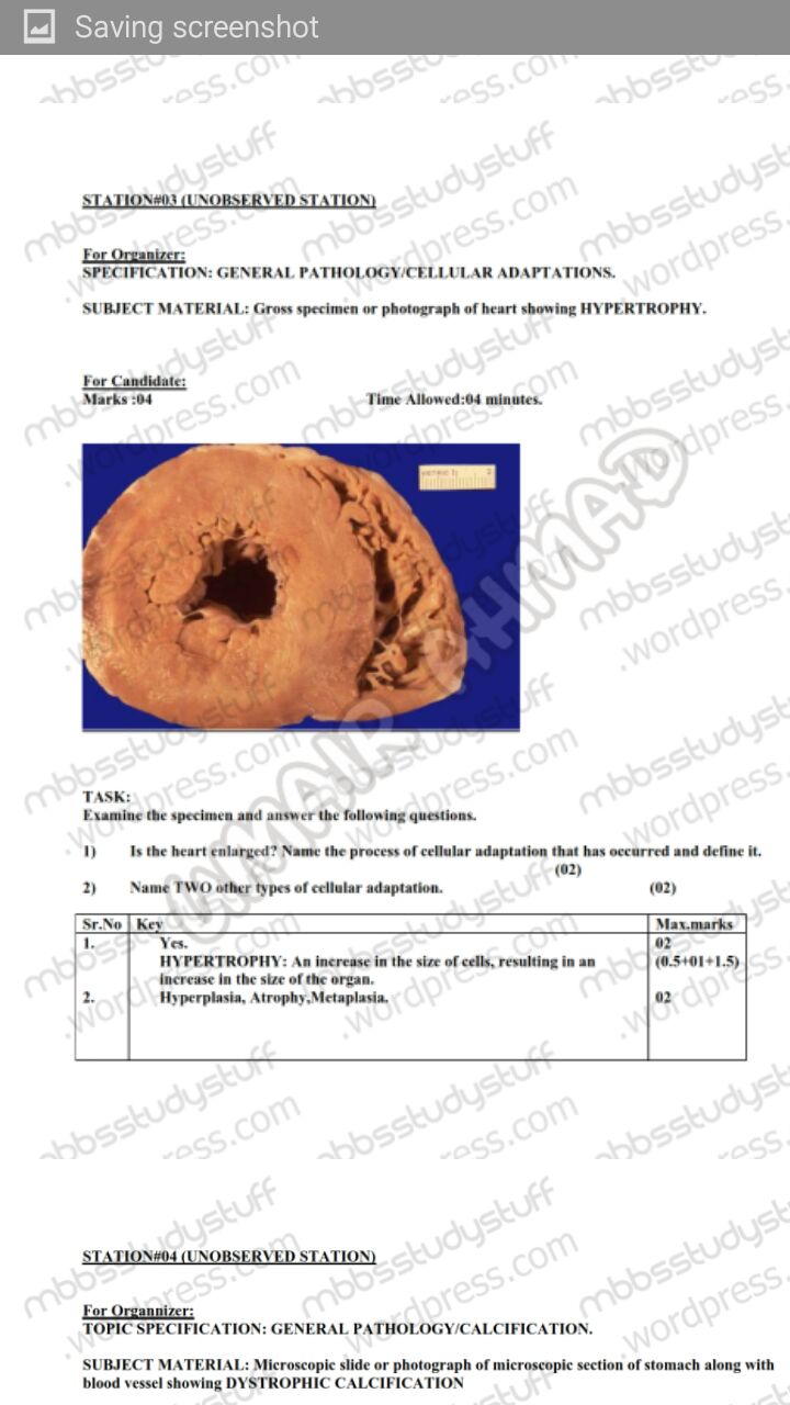 Quizzes/test and OSPE( Objective Structured Practical Examination).