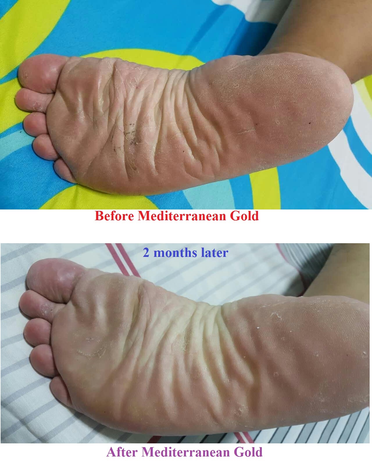 Malaysia Return Legacy Products(reviewed/explained)- Redoxy, Medigold ...