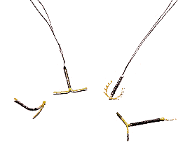 METODOS ANTICONSEPTIVOS