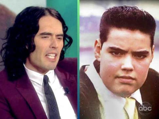 Russell Brand Plastic Surgery