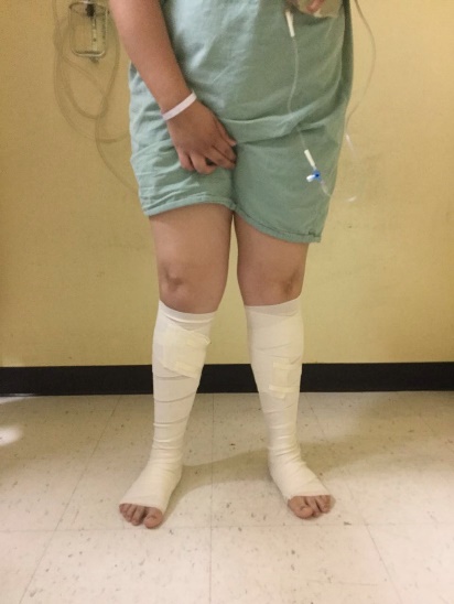 O R T O C R I T I C A: Inestabilidad rotuliana bilateral