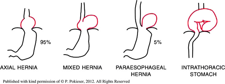 Doctor Ira Breite: Monday, March 20, 2017 on the Doctor Ira Breite