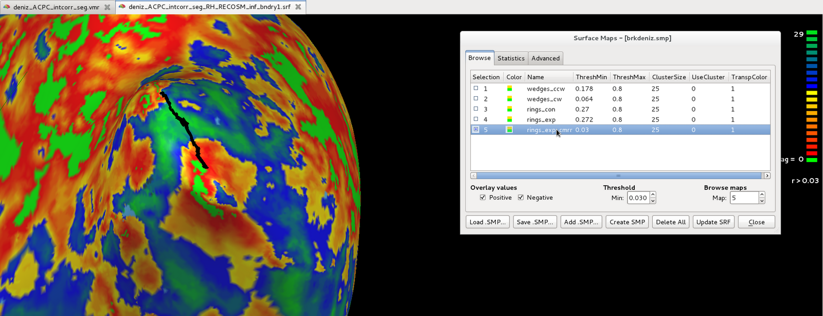 =Vision Group fMRI analysis guide=: Ring Stimulation with Single Shot ...