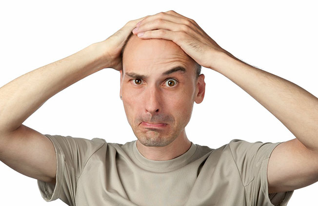 EL CALVARIO DE LA CALVICIE: ¿Cómo la calvicie afecta la calidad de vida?