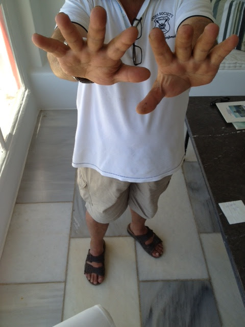 Murder is Everywhere: Obscene Gestures of the Ancient Greek