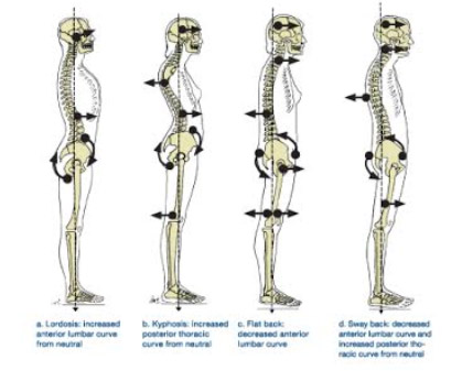 Center Island Performance Athletics: The Importance of Posture in ...