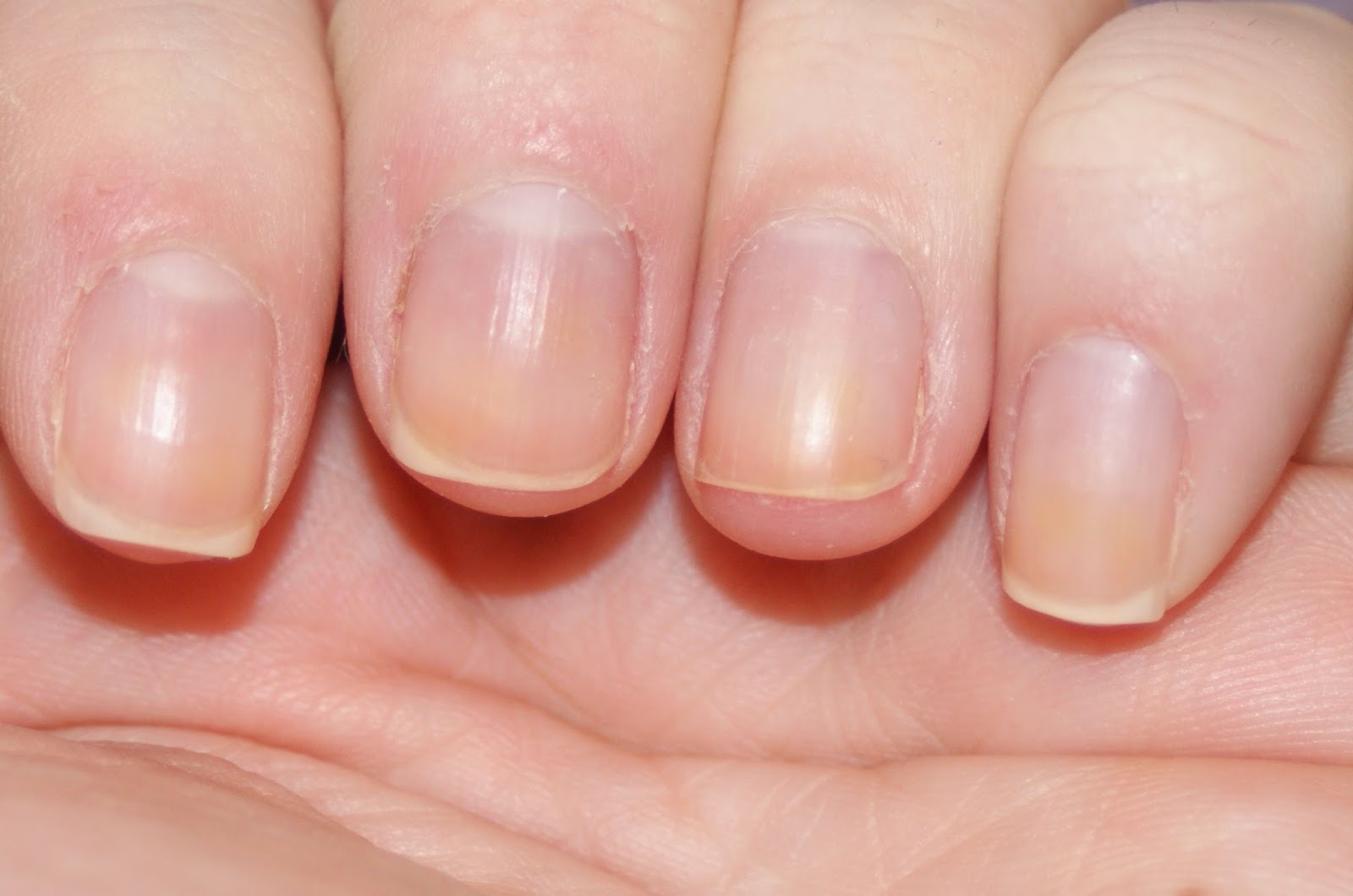 Princess Polish: Nail Rehab: Trind Perfect Cuticle and Nail Kit