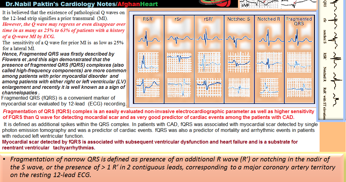 Dr Nabil Paktins Journal Of Cardiovascular Medicine Blog ژورنال قلب