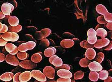 Materia Medica Homeopatica: PNEUMOCOCCUS (Neumococo. Sintomatología ...