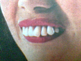 DentistMuslim88: ~~Hukum memakai braces di sisi Islam~~