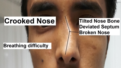 South Delhi Cosmetic Clinic- Best Cosmetic surgery Clinic in Delhi ...